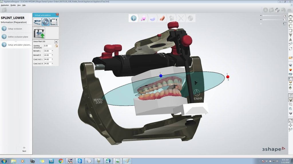 Digital Splints Today: Part 2 - The Pankey Institute
