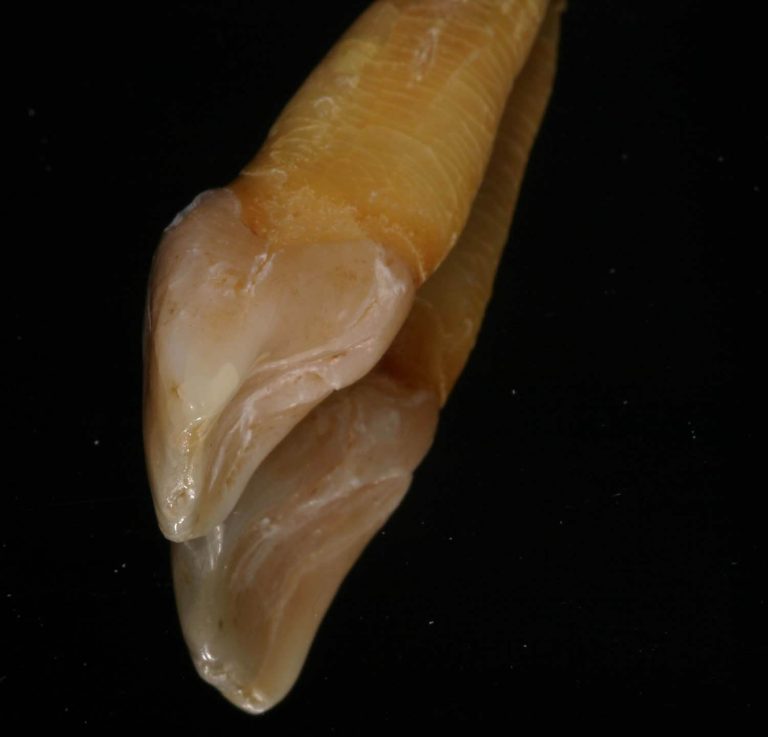 Dr. Pankey’s Take on Dental Aesthetics and the S Curve - The Pankey ...