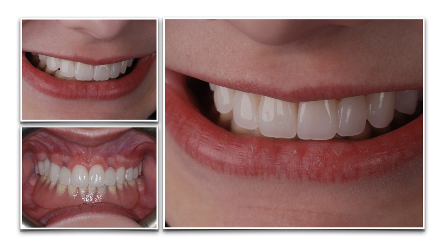 Best Day Ever - The Pankey Institute