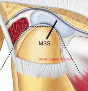 Centric Relation and the Colliding Bite - The Pankey Institute